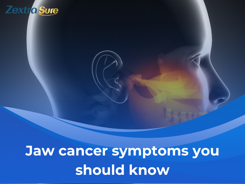 Jaw cancer symptoms you should know