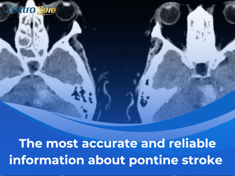 Tophi gout removal: Causes, treatment, and aftercare